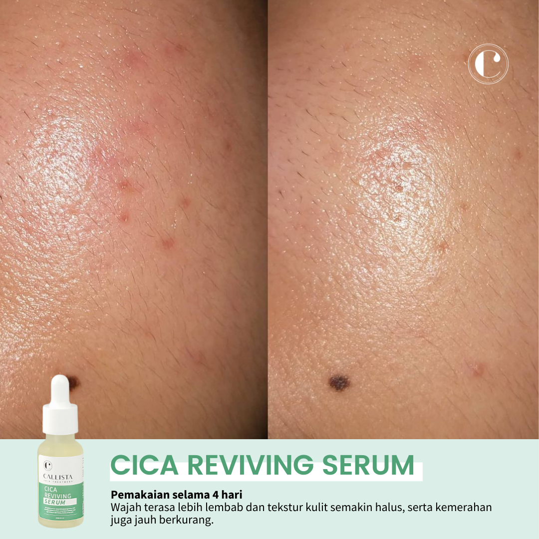 Cica Reviving Serum | CALLISTA