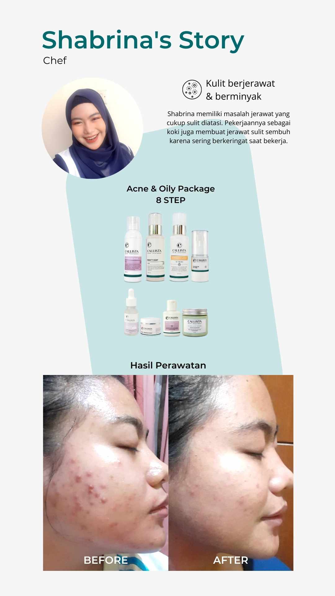 CALLISTA Skin Treatment | CALLISTA